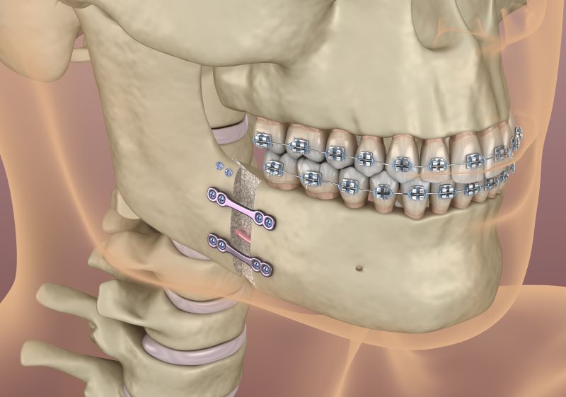 Sheng Ji, DDS, MD Oral & Maxillofacial Surgery Blog